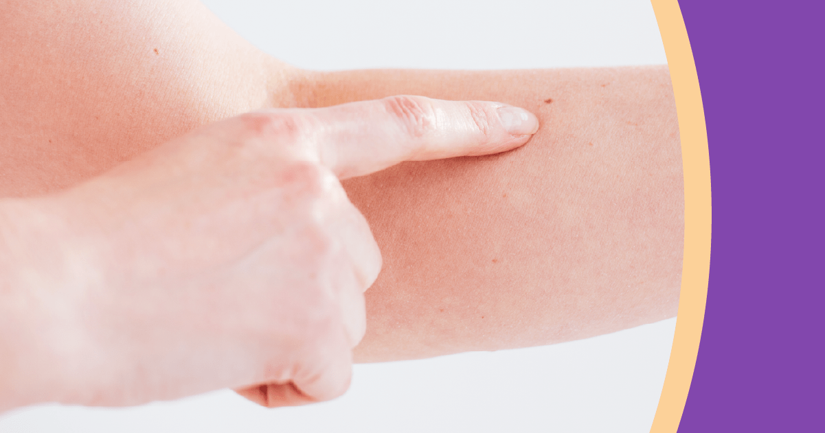 Social Media Trend Has Millennials Scanning for ‘Millennial Mole ...