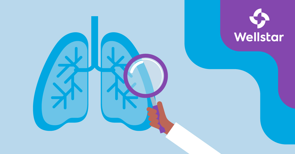 Wellstar Offers Saturday Hours for Lung Cancer Screening Day November 8 ...