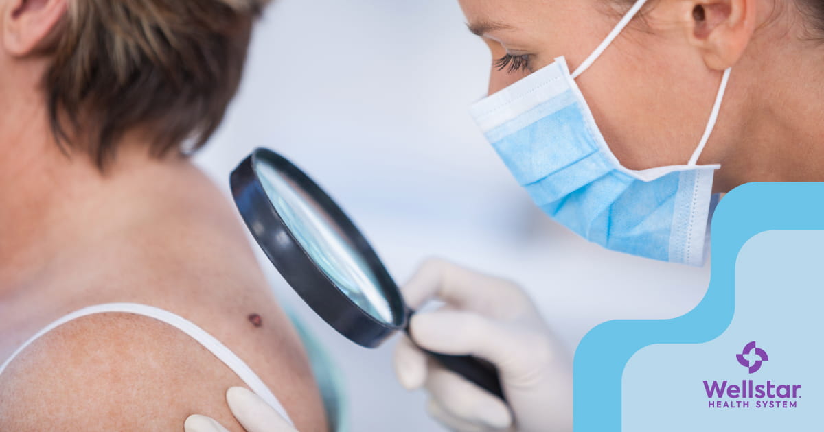 Spotting Skin Cancer Early